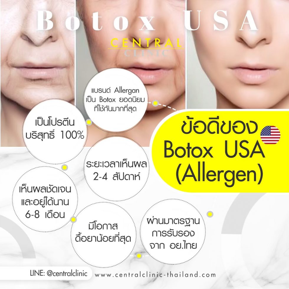 [PRO] Botox Korea Premium 100 Units 10,000 บาท | Central Clinic