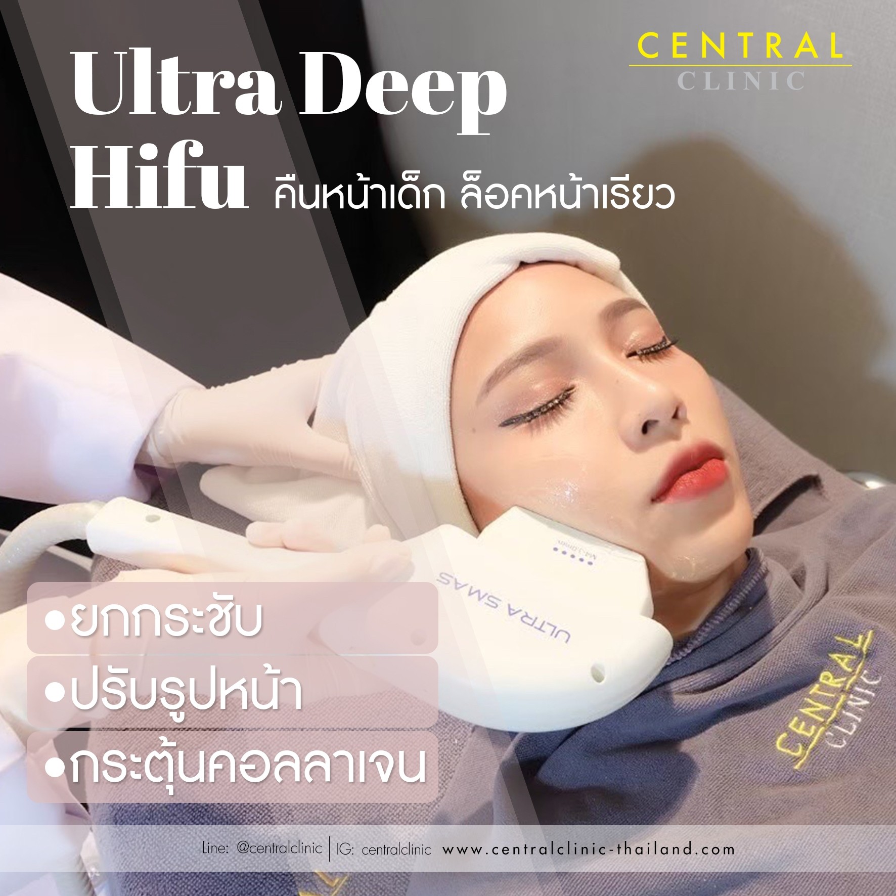 Ultra Deep HIFU 1 ครั้ง | Central Clinic