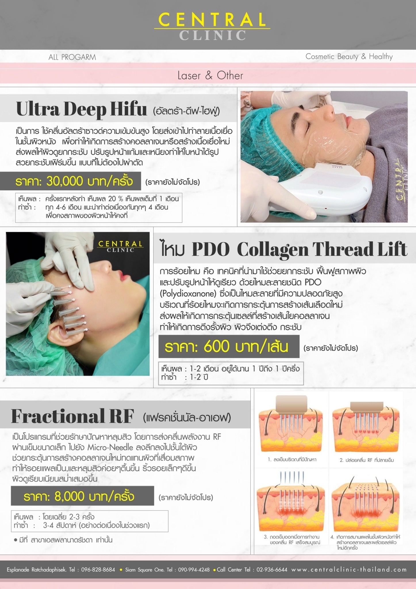 TH-INJECTION | Central Clinic