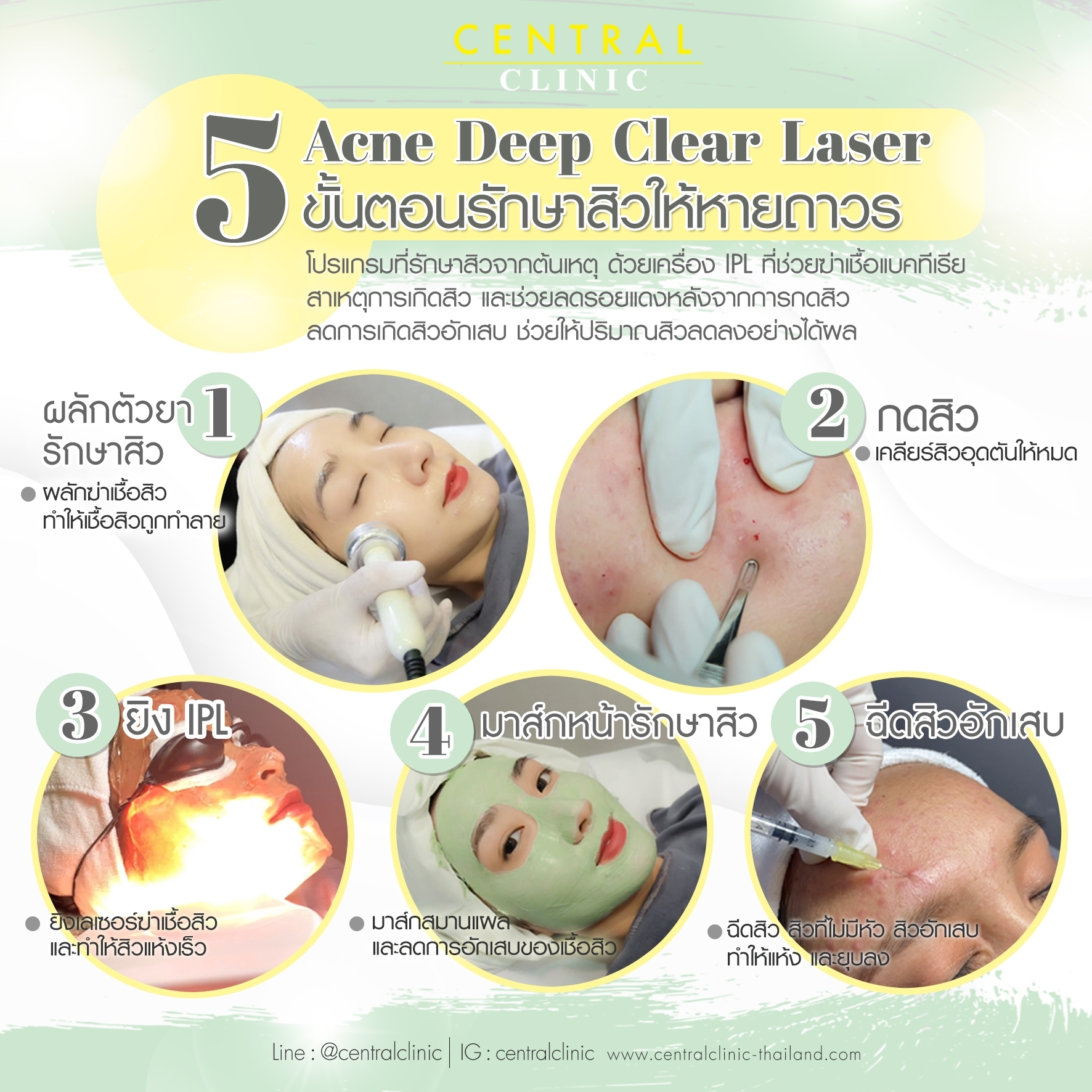 Acne Deep Clear | Central Clinic